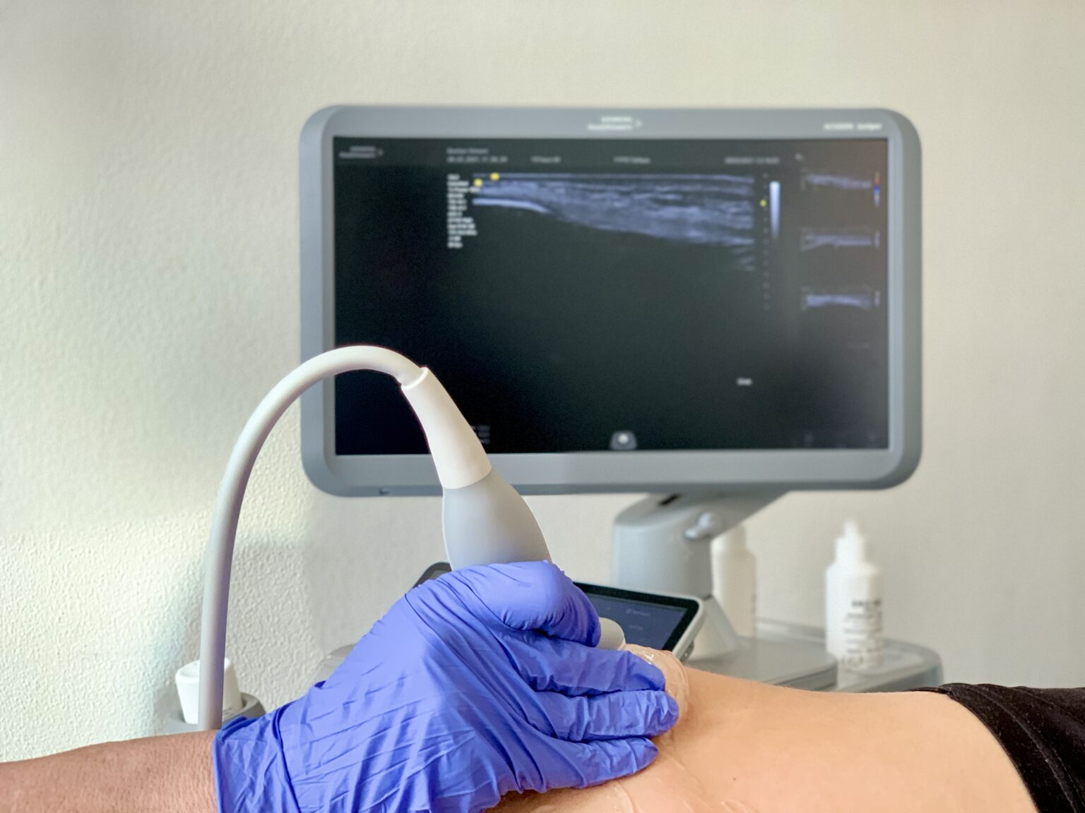 Ultralyd scanning – T-FYS